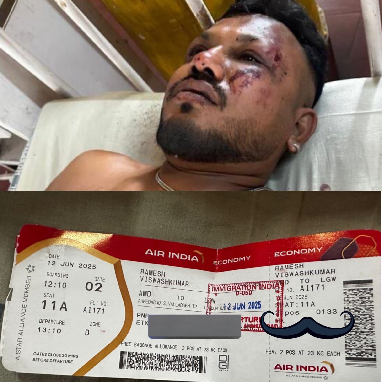 Air india plane crash : एयर इंडिया के विमान हादसे में सिर्फ एक व्यक्ति ...